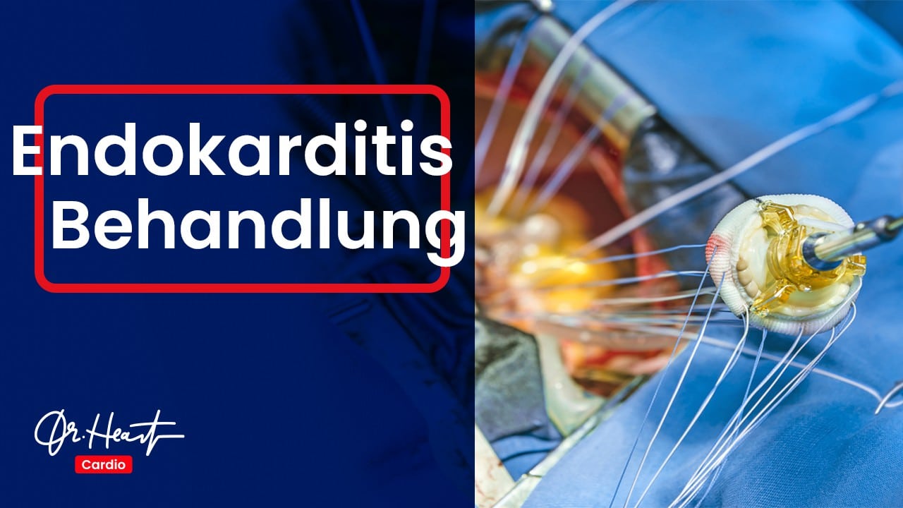 Endokarditis - Symptome und Behandlung – Dr. Heart