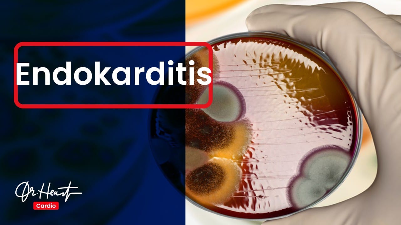 Endokarditis (Herzklappen-Entzündung) unbehandelt tödlich! – Dr. Heart